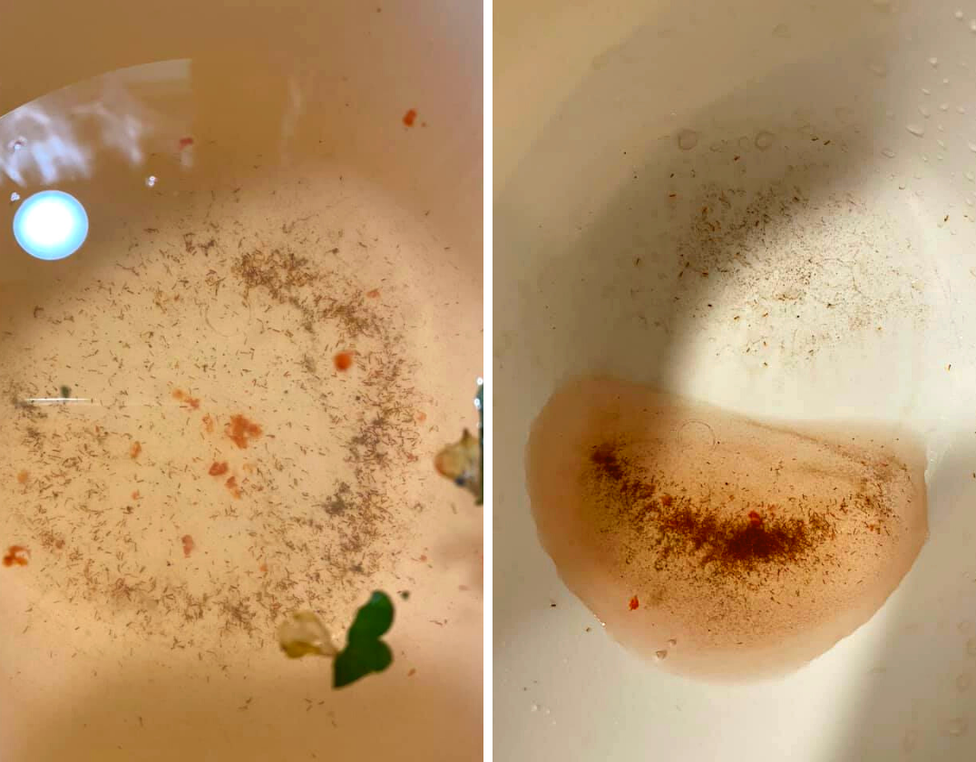 Apparently, when you put strawberries in salt water, tiny bugs crawl ...
